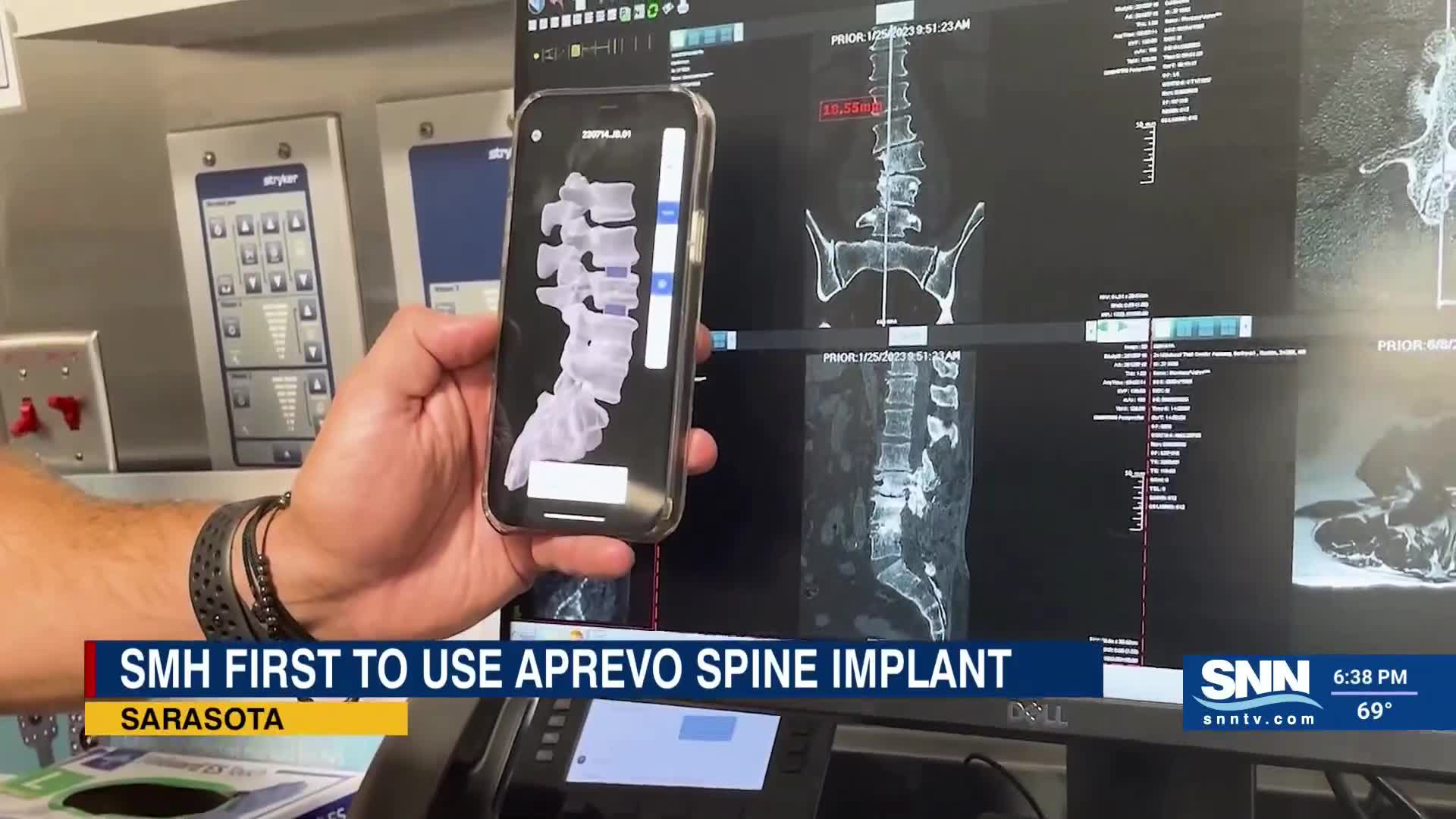 Sarasota Memorial Hospital performing new spinal implant surgery – SNN News